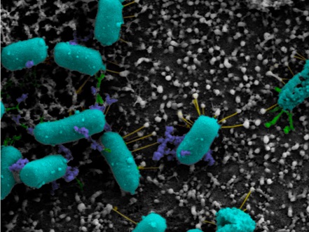 Mass General researchers uncover early adherence step hidden in plain ...