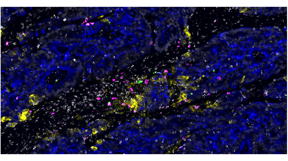 Hacohen Lab | Massachusetts General Hospital